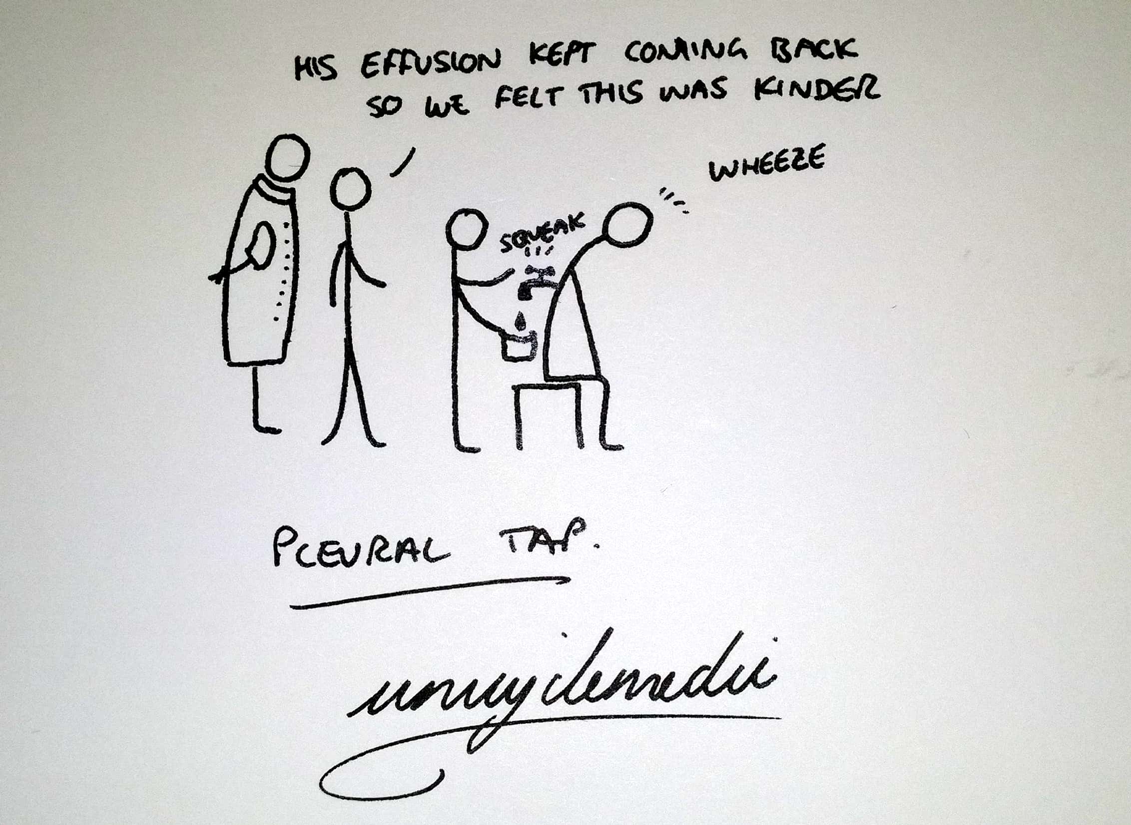 Pleural Tap – unicyclemedic